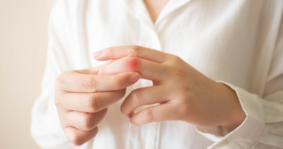 Pijnloze zwelling aan de vinger - Ortho-Rhumato