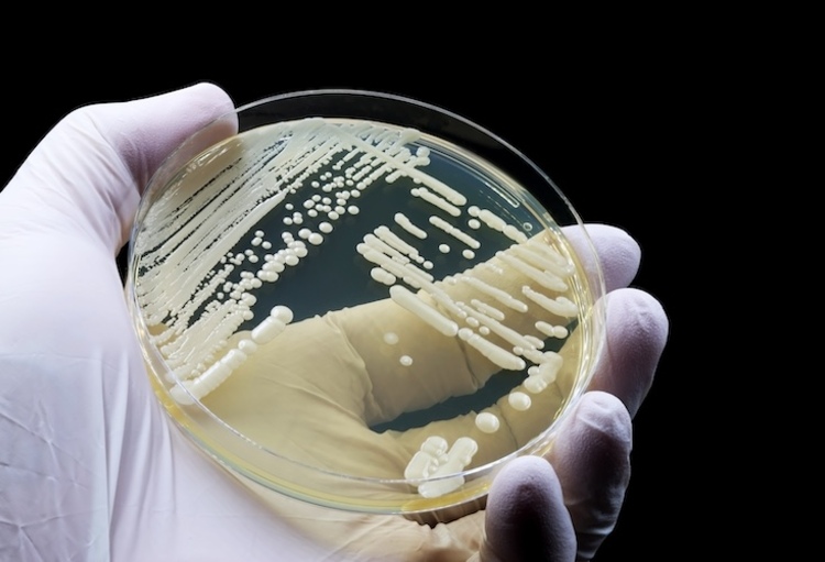 KU Leuven-onderzoek kan leiden tot nieuwe behandeling tegen dodelijke schimmel - Medi-Sfeer