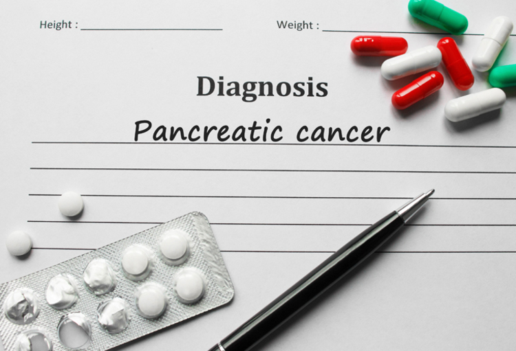 Les recommandations pour le cancer du pancréas mises à jour par le KCE ...