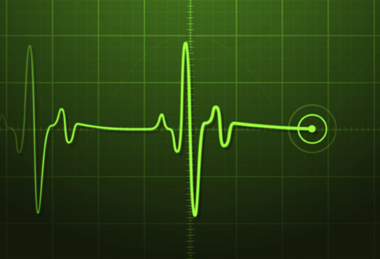 Ventriculaire tachycardie en fibrillatie op spoedgevallen: diagnose en ...