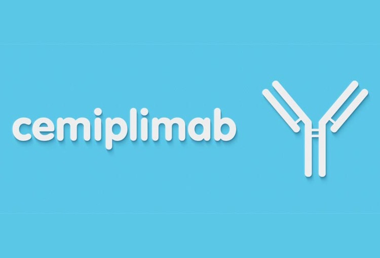 Cemiplimab, een checkpointremmer, bij spinocellulair carcinoom van de ...