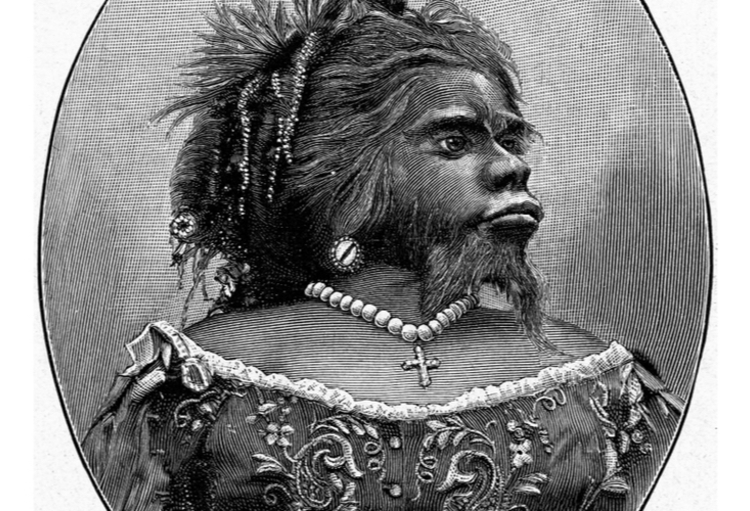 hypertrichose - Skin