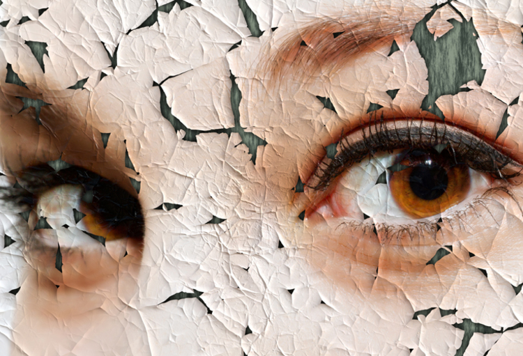 Stress et pathologies cutanées - Pharma-Sphere