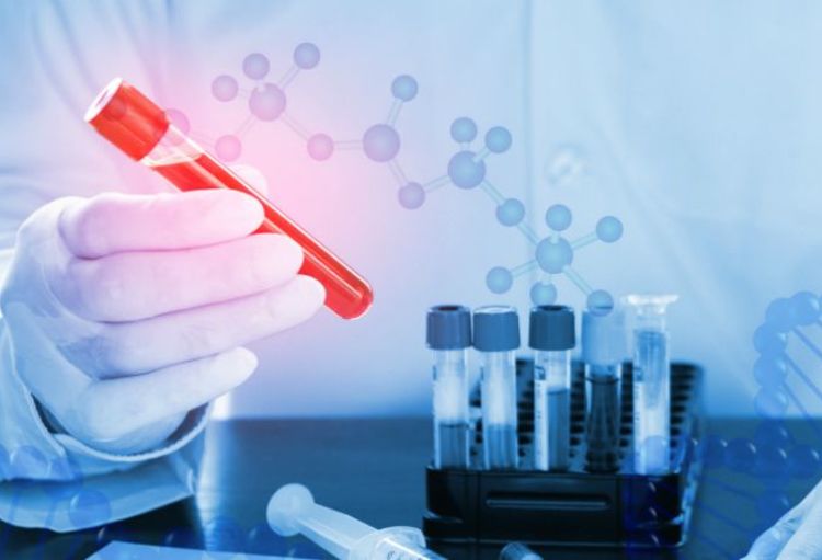 CancerSeek : un nouveau test sanguin qui détecte 8 cancers courants ...