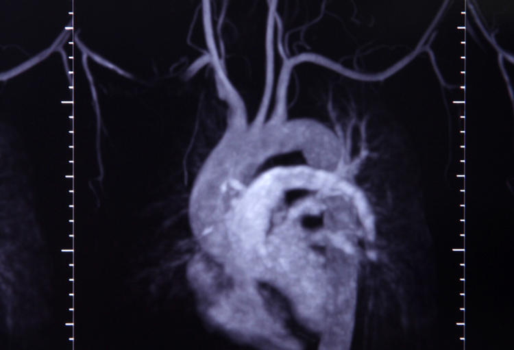 Nieuwe techniek realiseert doorbraak bij vroeg opsporen zuurstoftekort ...