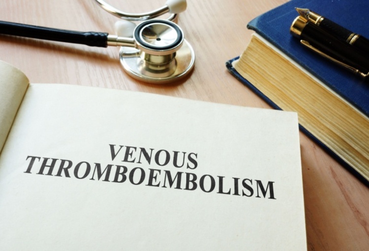 Un score simple pour déterminer le risque de TEV en cas d ...