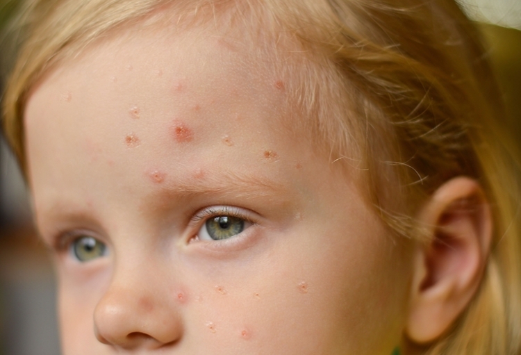 Apentekeningen Voor Kinderen Kinderen Voor Kinderen Zapp