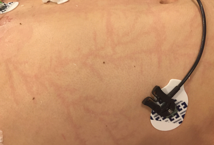 Gagnant du prix Skin 2019 - Skin