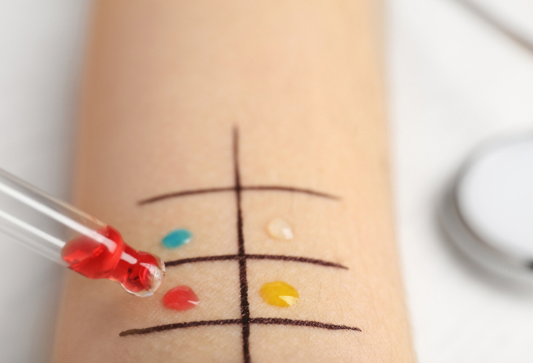 Test de provocation avec agents chimiothérapiques sans positivité des ...