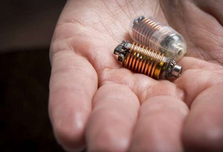 Darmgassen meten met slimme capsule - De Specialist